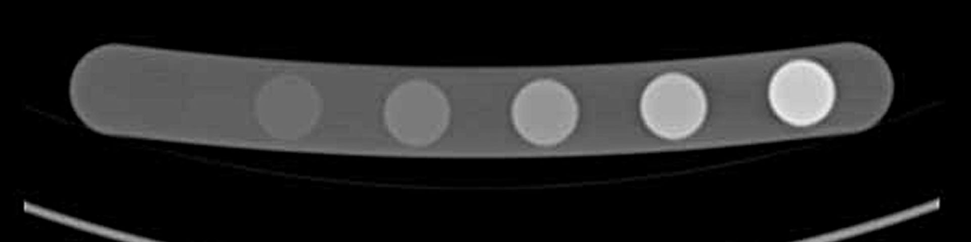 Bone Density Calibration Phantoms | A PTW Company