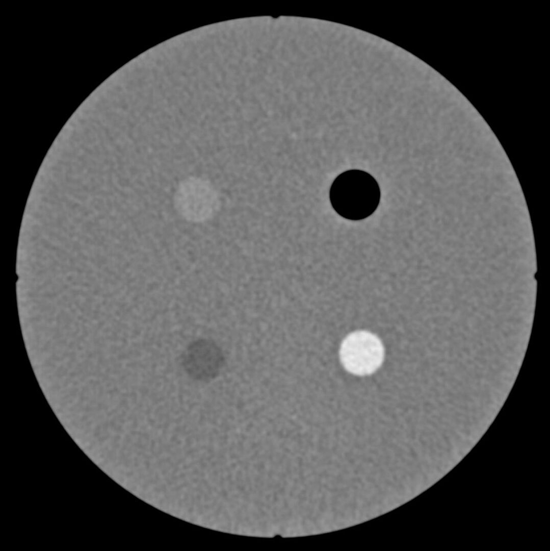 Breast CT QA Phantom | A PTW Company