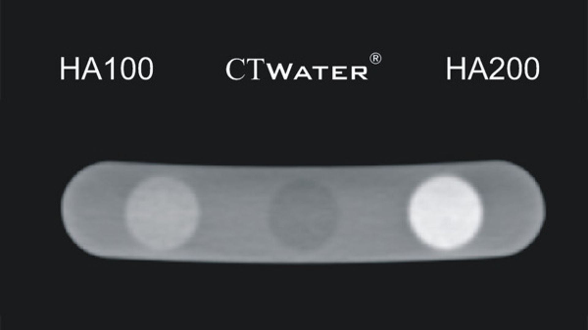 Bone Density Calibration Phantom, customized - A PTW Company